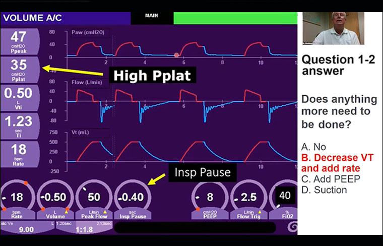 Virtual simulation offers insights to graphical analysis of ventilator ...