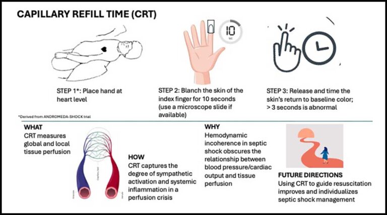 Capillary refill time: Advancing perfusion-targeted resuscitation in ...
